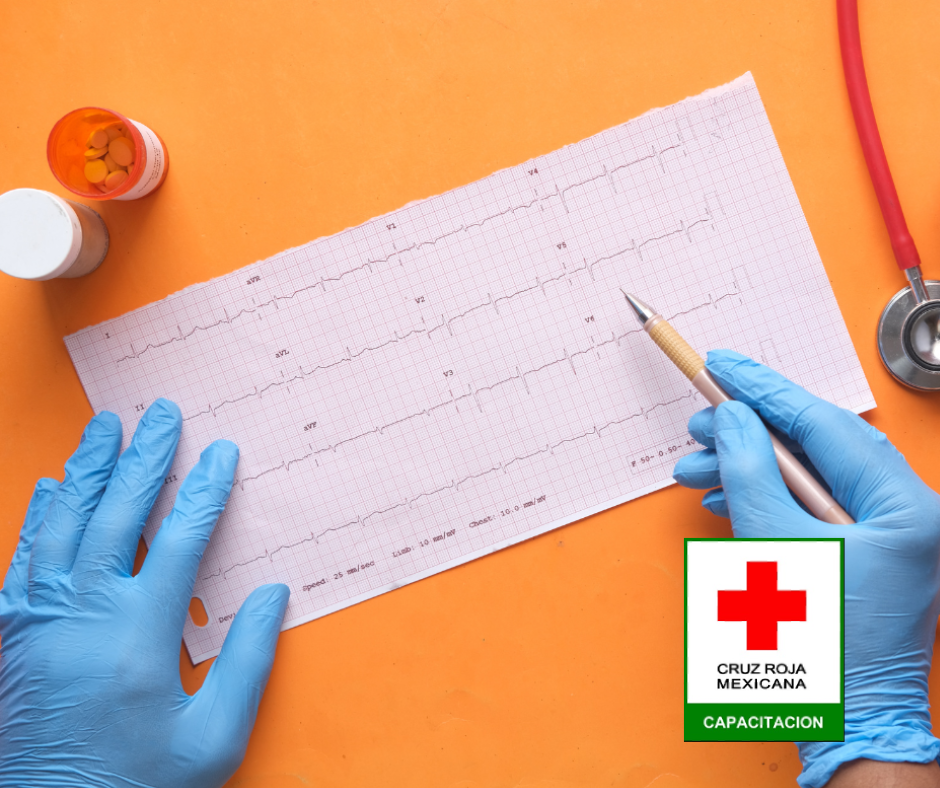 Electrocardiografía Avanzada CECEM – Cruz Roja CECEM